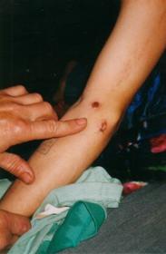 Electrical injuries and deaths | EBSCO Research Starters